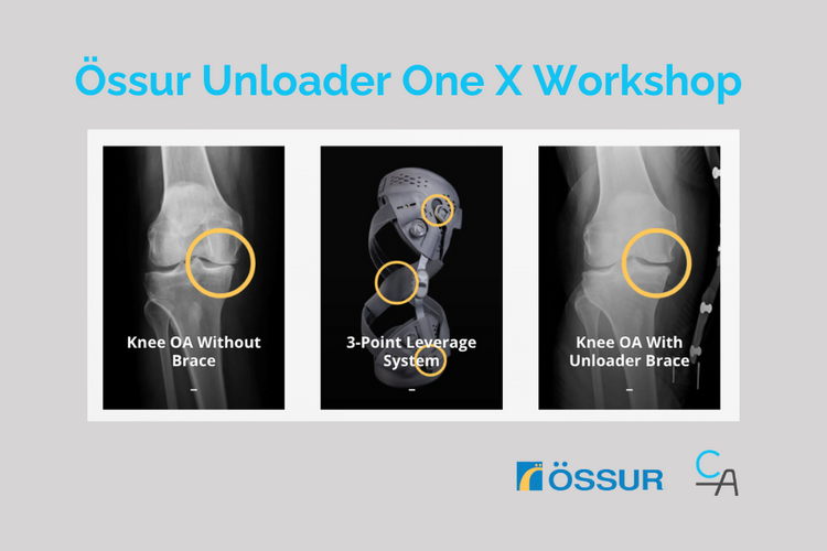 Össur Unloader One X Brace Workshop – capeabilitiesshop